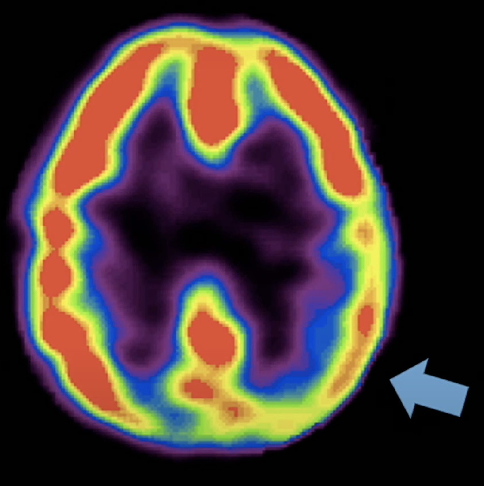 How Enlightenment Changes Your Brain - Be Awake