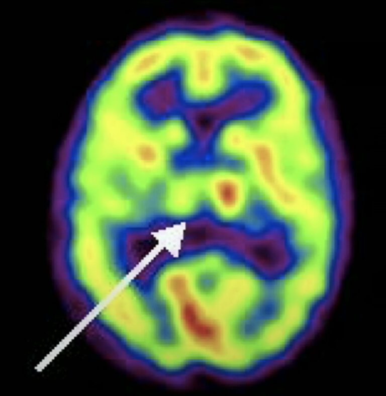 How Enlightenment Changes Your Brain – Be Awake